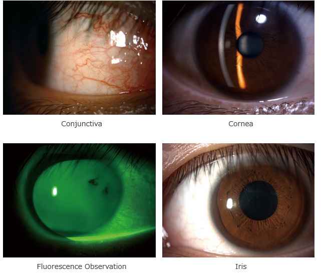 Sinh hiển vi Khám mắt : SL-D301 - Digital Slit Lamp